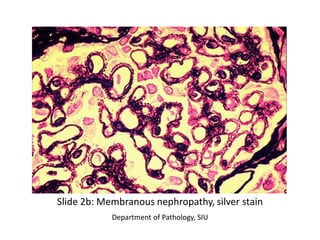 Urinary system Tutorial Renal Pathology.pdf