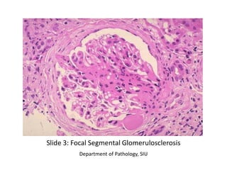 Urinary system Tutorial Renal Pathology.pdf