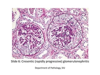 Urinary system Tutorial Renal Pathology.pdf