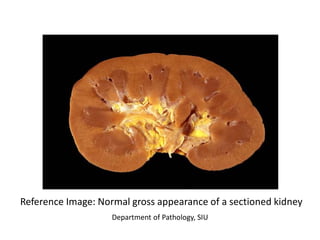 Urinary system Tutorial Renal Pathology.pdf