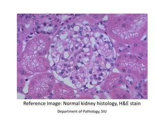 Urinary system Tutorial Renal Pathology.pdf