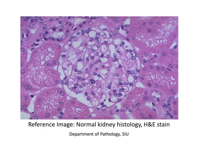 Urinary system Tutorial Renal Pathology.pdf
