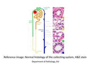 Urinary system Tutorial Renal Pathology.pdf