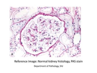 Urinary system Tutorial Renal Pathology.pdf