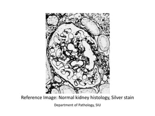 Urinary system Tutorial Renal Pathology.pdf