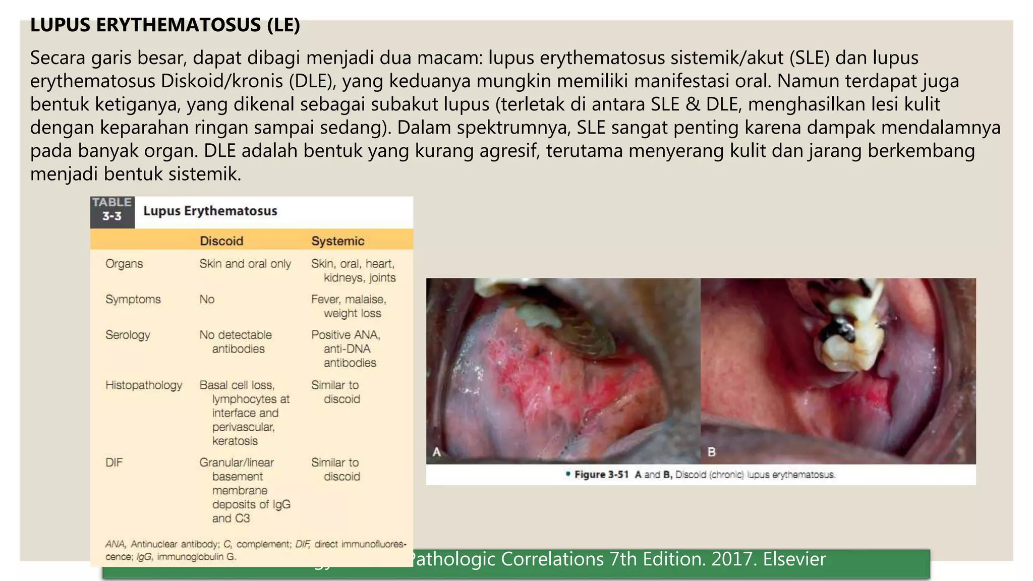 Lesi Putih, Variasi Normal, Leukoplakia | PPTX