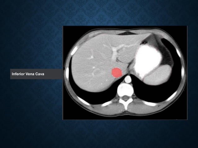 Tutorial Abdominal CT scan test.pdf | Endocrine and Metabolic Diseases ...