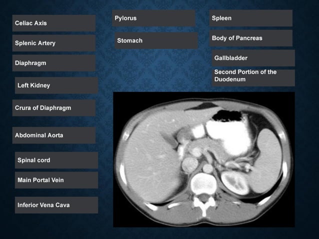 Tutorial Abdominal CT scan test.pdf | Endocrine and Metabolic Diseases ...