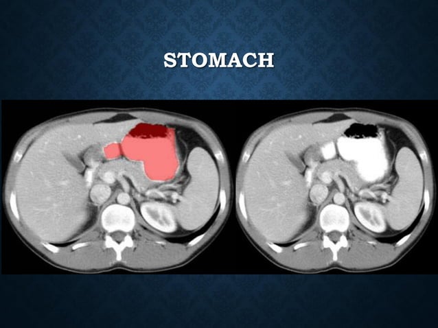 Tutorial Abdominal CT scan test.pdf | Endocrine and Metabolic Diseases ...