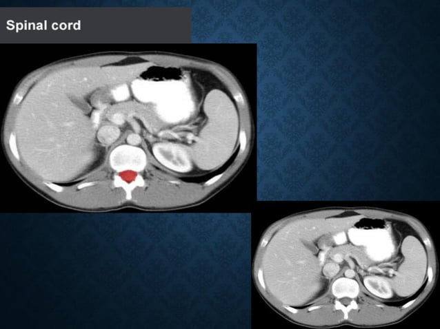 Tutorial Abdominal CT scan test.pdf | Endocrine and Metabolic Diseases ...