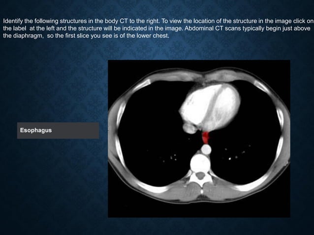 Tutorial Abdominal CT scan test.pdf | Endocrine and Metabolic Diseases ...