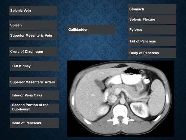 Tutorial Abdominal CT scan test.pdf | Endocrine and Metabolic Diseases ...