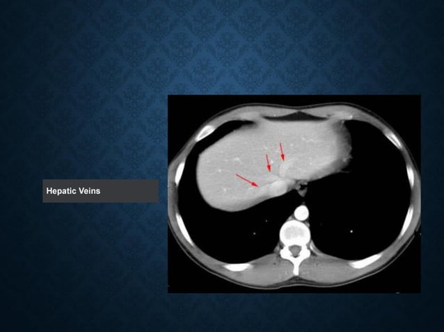 Tutorial Abdominal CT scan test.pdf | Endocrine and Metabolic Diseases ...