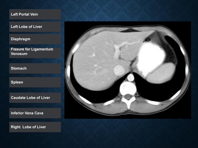 Tutorial Abdominal CT scan test.pdf | Endocrine and Metabolic Diseases ...
