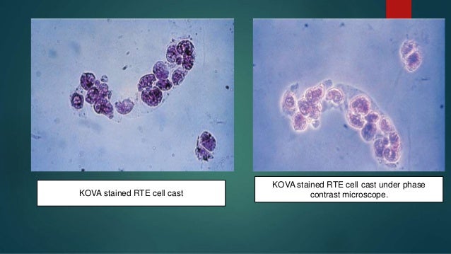 Urine Analysis Part2