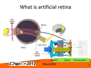 Practical solutions in ultra low power design for artificial retina | PPT