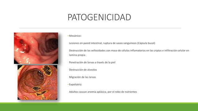 Bunostomum trigonocephalum | PPTX
