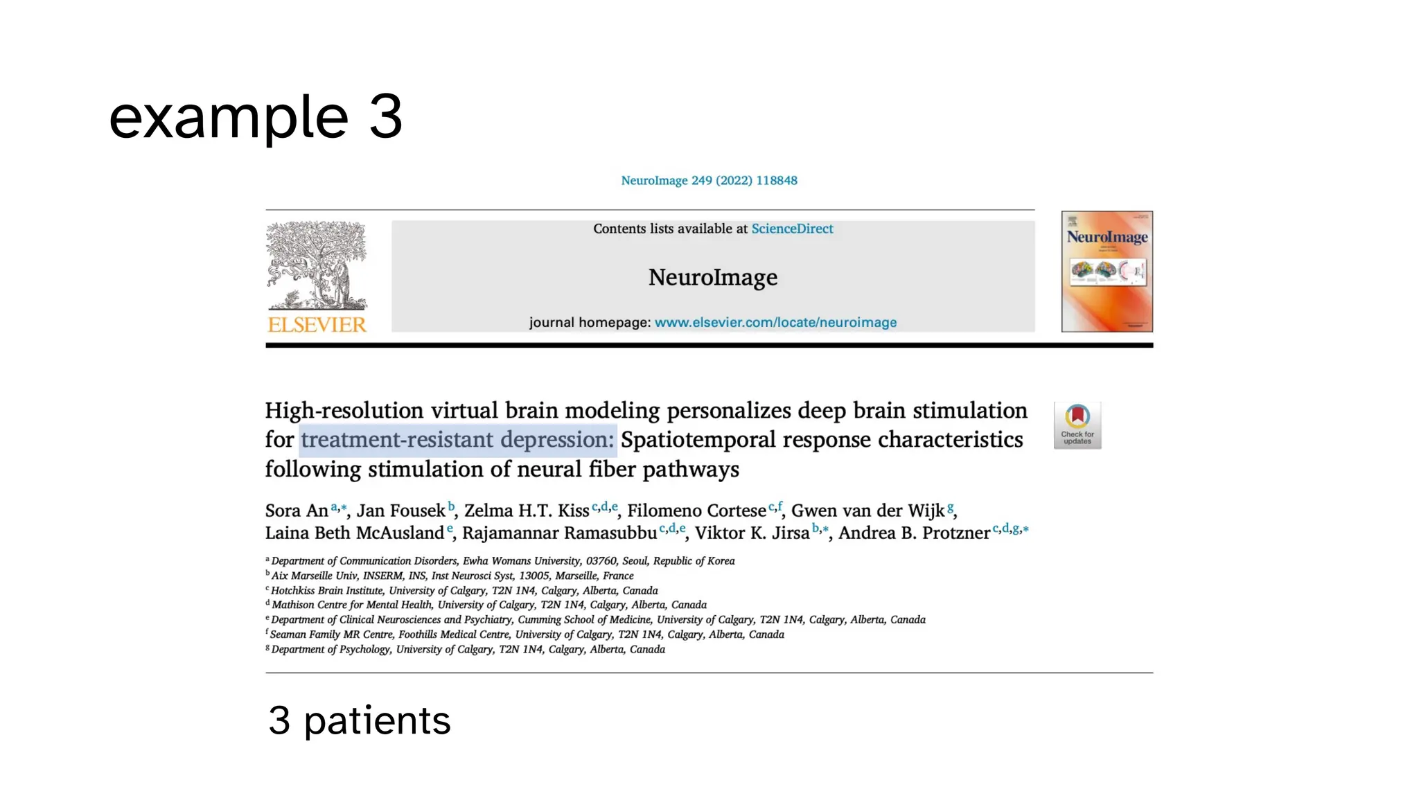 The virtual brain: an introduction and 3 clinical examples | PPT | Free ...