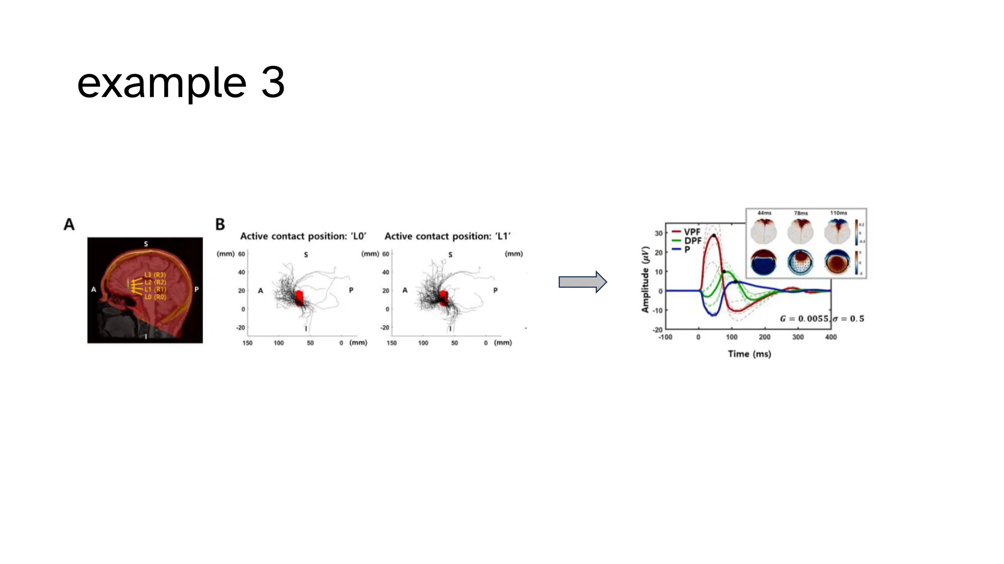 The virtual brain: an introduction and 3 clinical examples | PPT