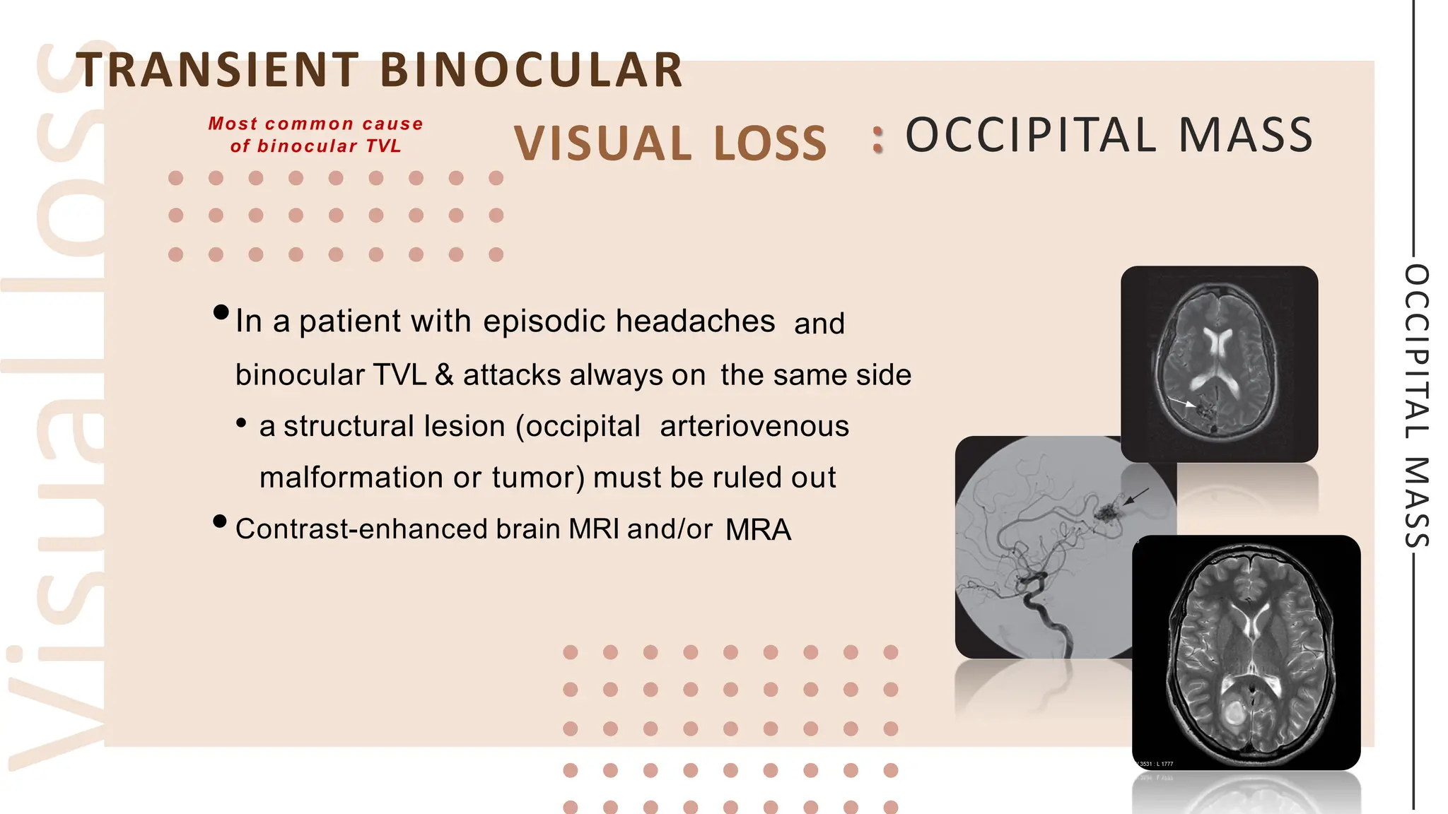 approach to transient visual loss in clinical practice // | PDF