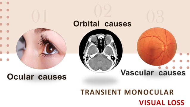 approach to transient visual loss in clinical practice // | PDF | Eye ...