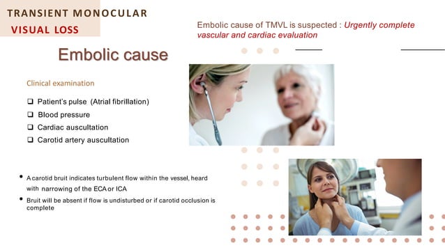 approach to transient visual loss in clinical practice | PDF