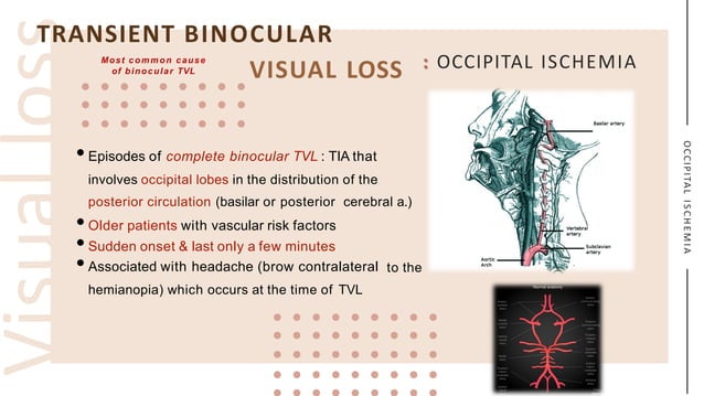 approach to transient visual loss in clinical practice | PDF