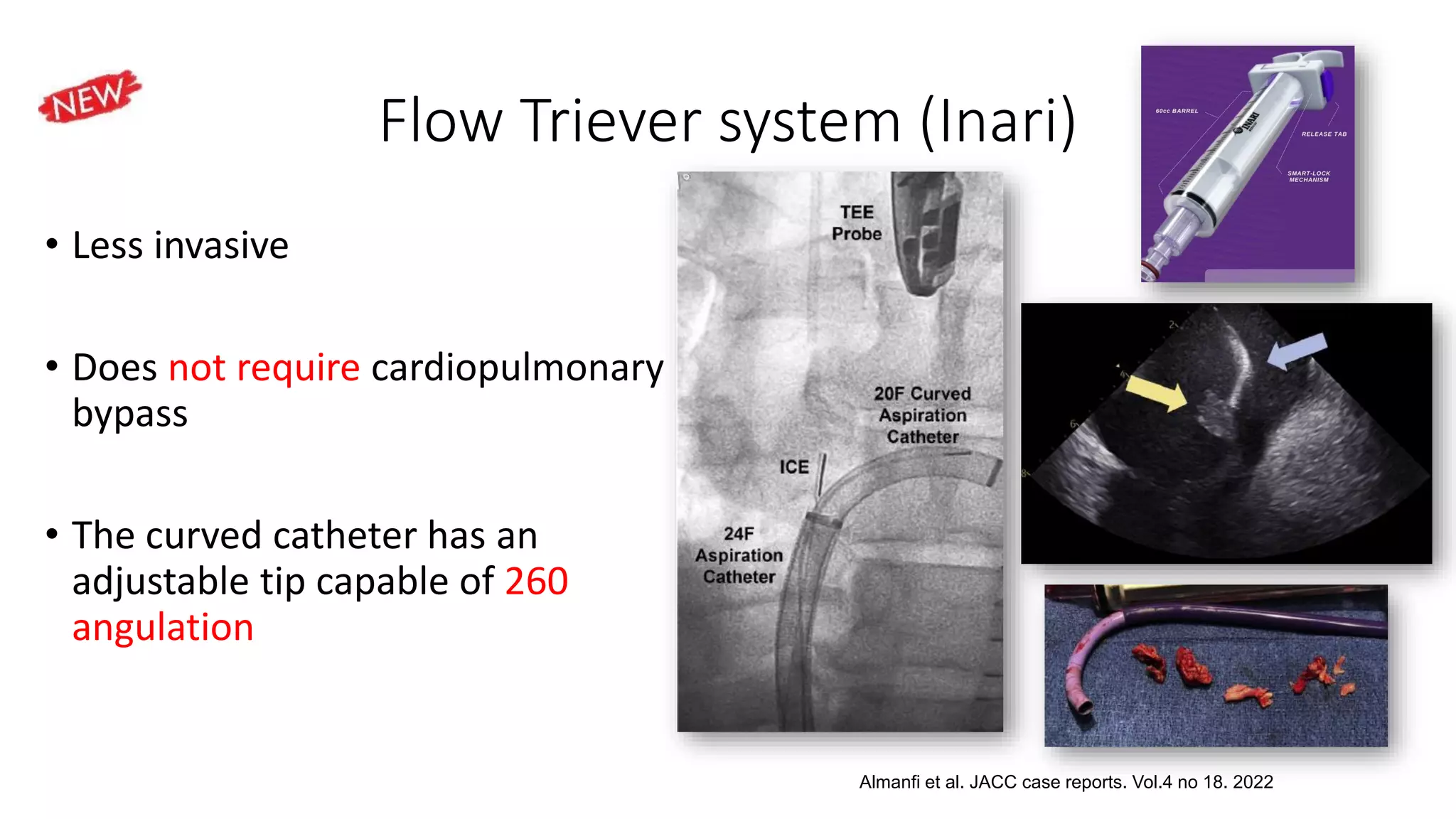 Novel management options for tricuspid endocarditis | PDF