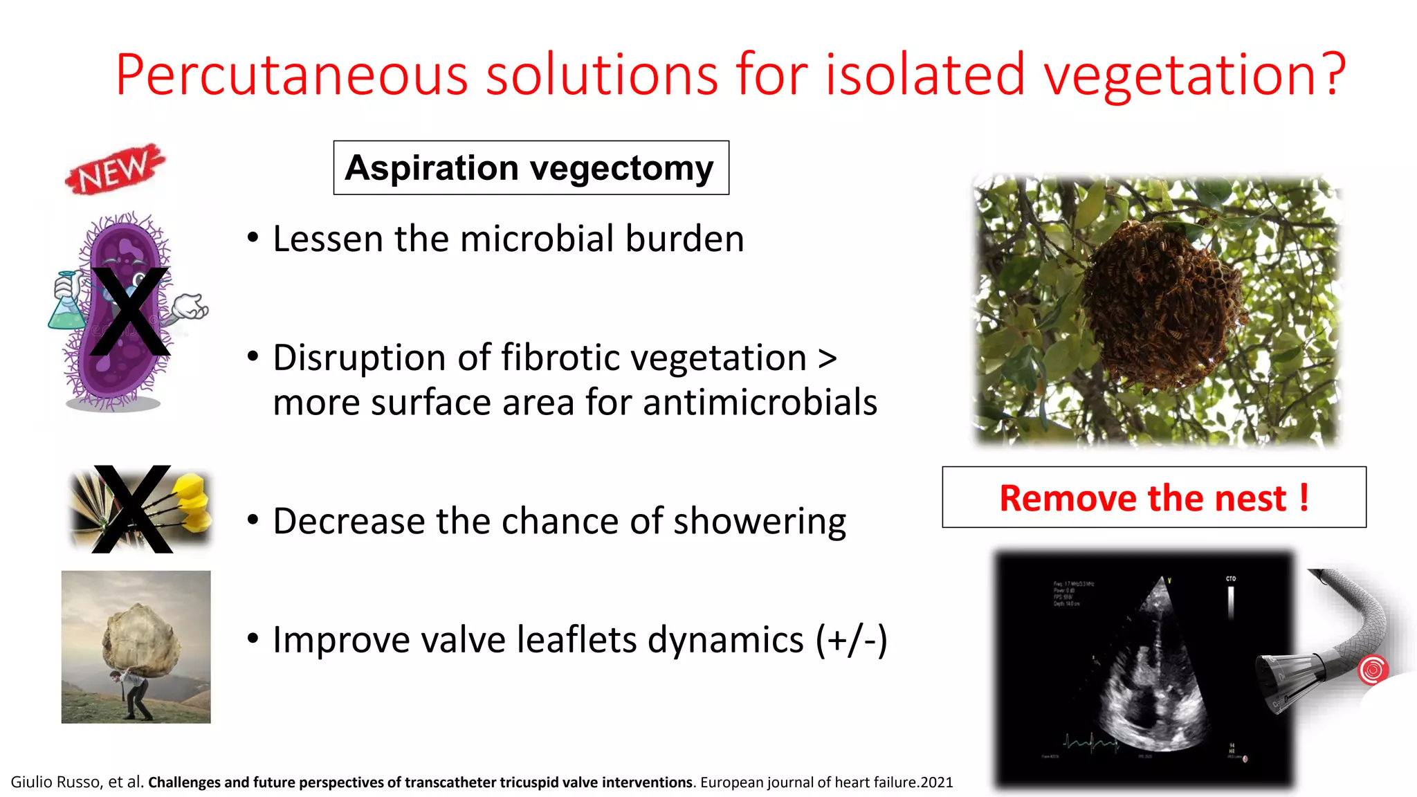 Novel management options for tricuspid endocarditis | PDF
