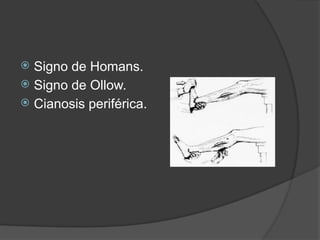 Trombosis venosa profunda de miembros inferiores.pptx