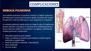 Trombosis Venosa Profunda | PPTX