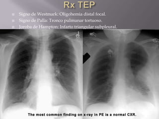 Tvp fisiopatologia | PPTX