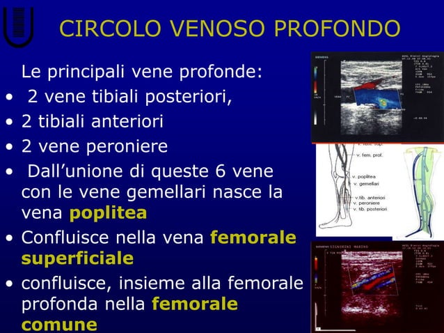 TROMBOSI VENOSA PROFONDA TVP LEZIONE MEDICINA INTERNA ROBERTO LEO 2019 ...
