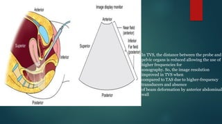 TVS structure seen and techniques for better vid | PPTX