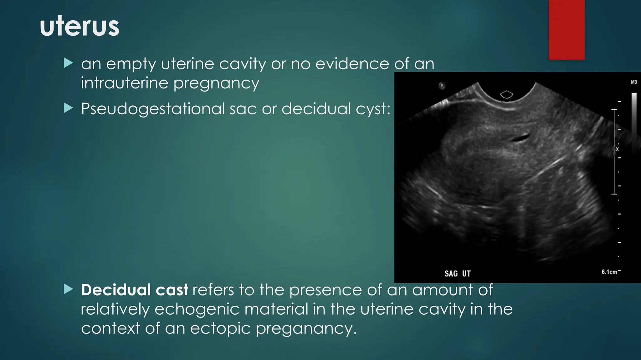 TVS howto do lesionsin tvs findings of LESIONS | PPT
