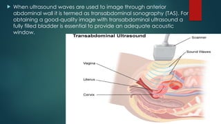 TVS howto do lesionsin tvs findings of LESIONS | PPTX