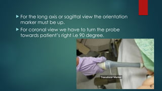 TVS howto do lesionsin tvs findings of LESIONS | PPTX
