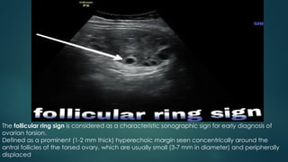 TVS howto do lesionsin tvs findings of LESIONS | PPTX