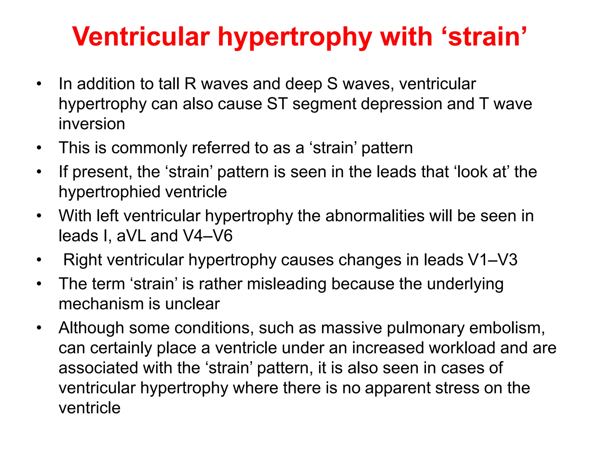 T WAVE IN ECG AND ITS ABNORMALITIES IN ECG | PPTX