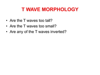 T WAVE IN ECG AND ITS ABNORMALITIES IN ECG | PPTX