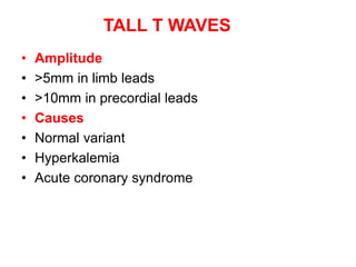 T WAVE IN ECG AND ITS ABNORMALITIES IN ECG | PPTX