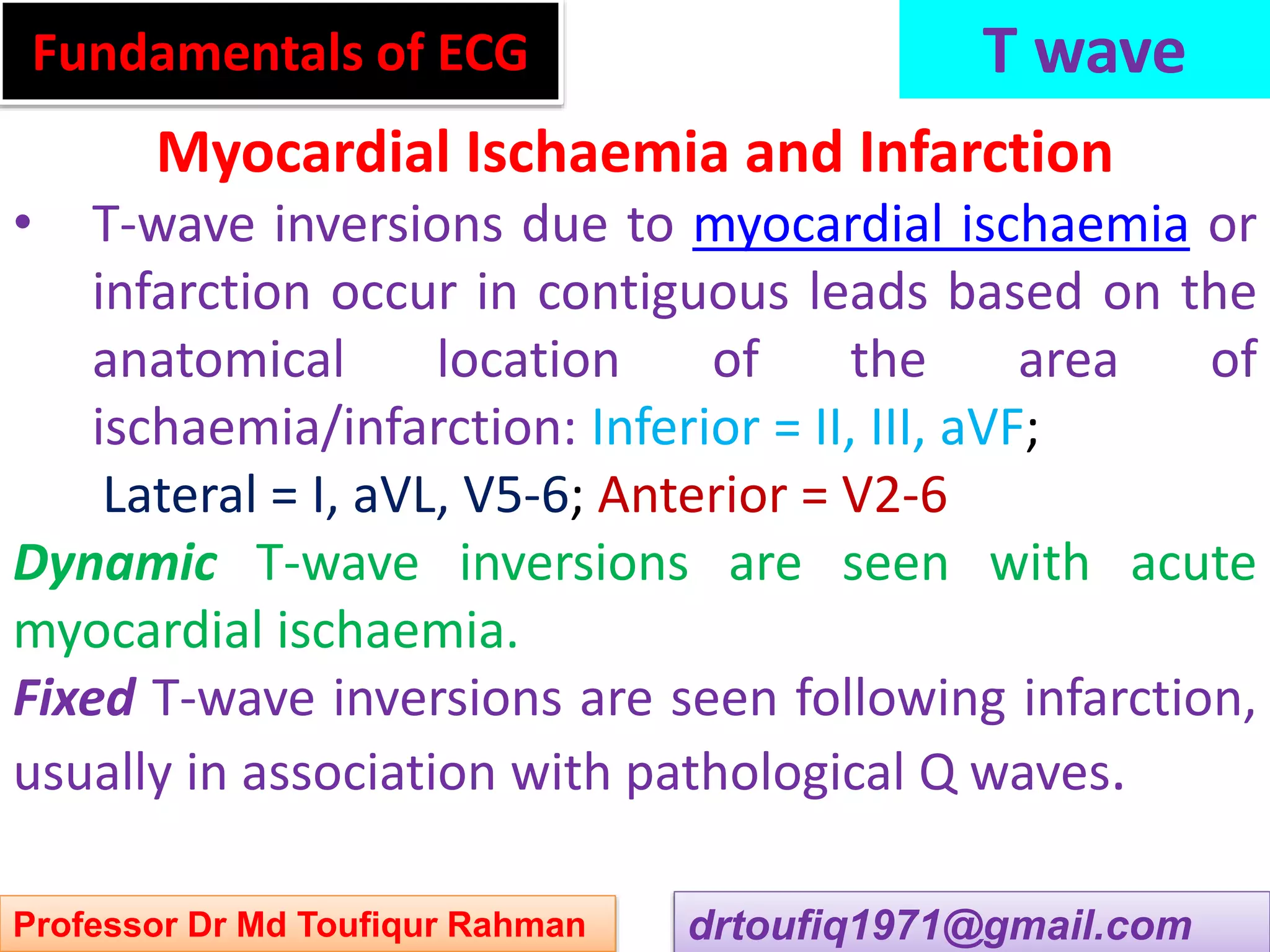 Approach To A Patient With T Wave Abnormality In Ecg Ppsx Heart And Cardiovascular Diseases