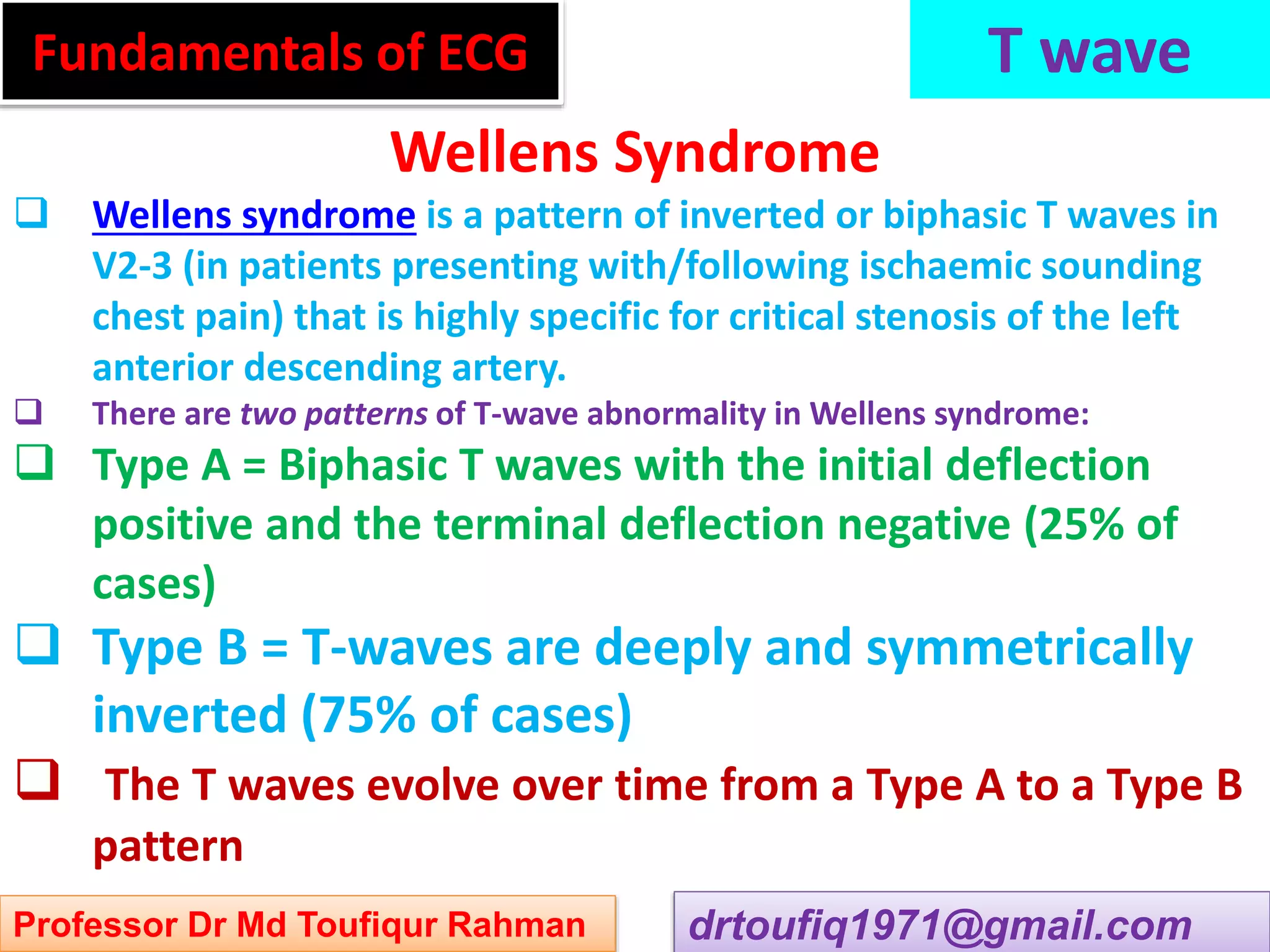 Approach to a patient with T wave abnormality in ECG | PPSX