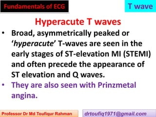 Approach to a patient with T wave abnormality in ECG | PPSX