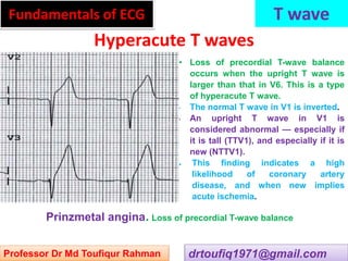 Approach to a patient with T wave abnormality in ECG | PPT