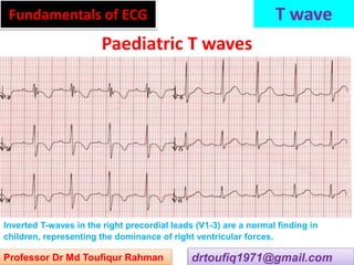 Approach to a patient with T wave abnormality in ECG | PPSX