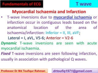Approach to a patient with T wave abnormality in ECG | PPSX