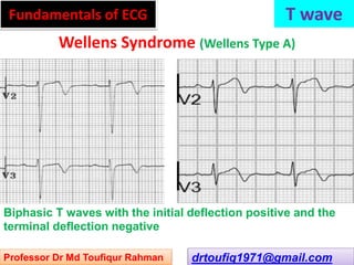 Approach to a patient with T wave abnormality in ECG | PPSX