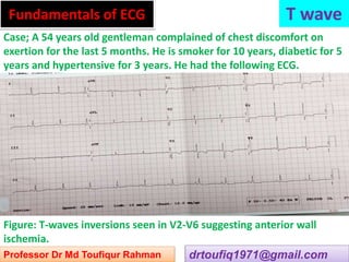 Approach to a patient with T wave abnormality in ECG | PPSX