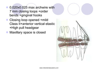 Tweed merrifield /certified fixed orthodontic courses by Indian dental ...